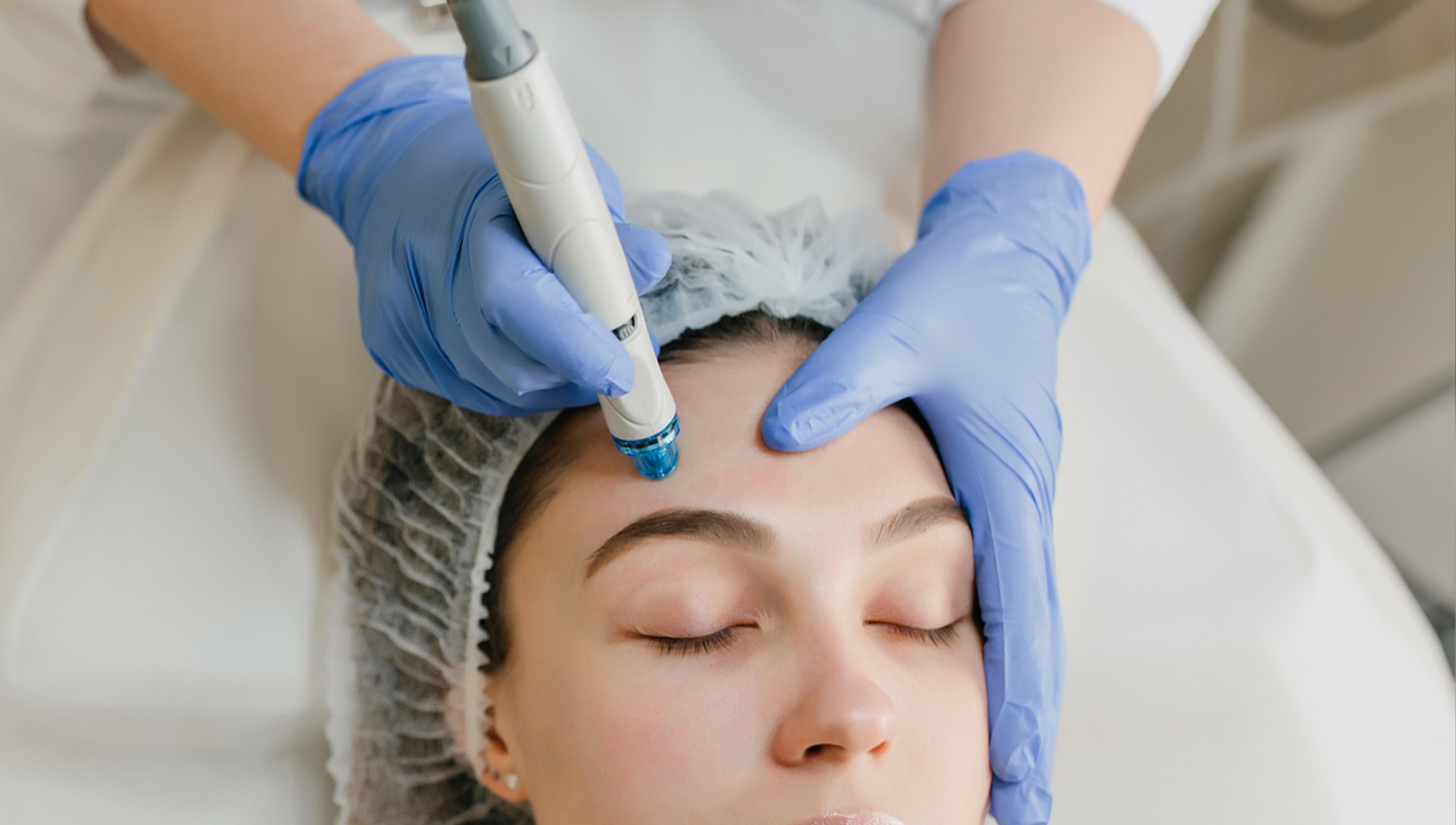 What Is Dermapen 4? The Latest Innovation in Microneedling Explained